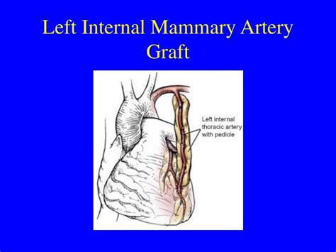 Ppt Ischaemic Heart Disease Powerpoint Presentation Id816453