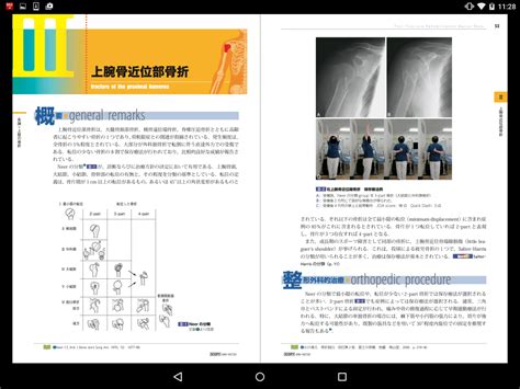 M Plus