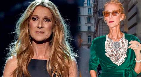 Céline Dion Y El Síndrome De Persona Rígida De Qué Trata La Enfermedad