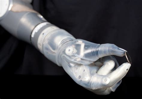 How Close Are We To Bionic Skin