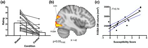 Susceptibility To Illusion And Neural Correlates A Individual Download Scientific Diagram