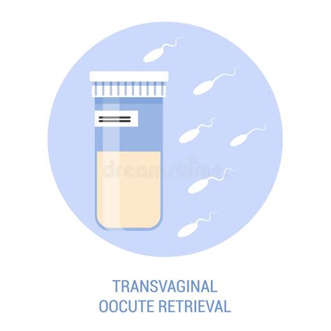 In Vitro Fertilisation Step Placing Embryo Into Woman Uterus Stock