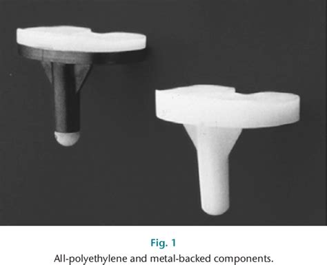 Figure 1 From All Polyethylene Tibia Components Have The Same
