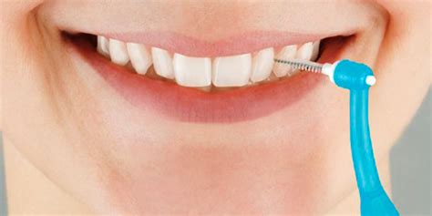 Cómo se usa un cepillo interdental consejos e instrucciones Clínica