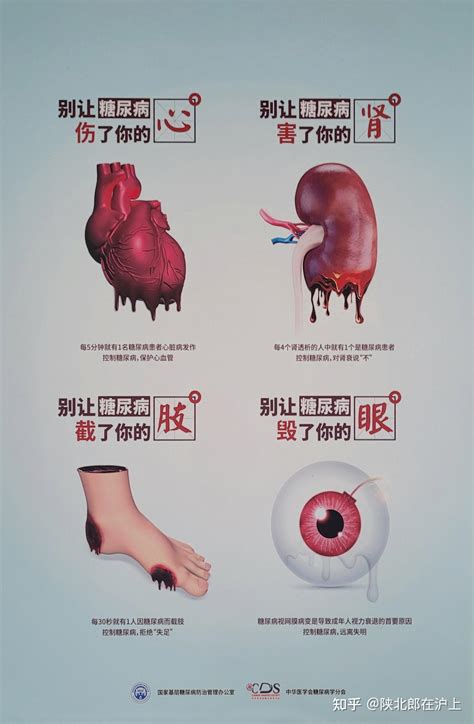 糖尿病发作时常伴随着什么症状？ 知乎