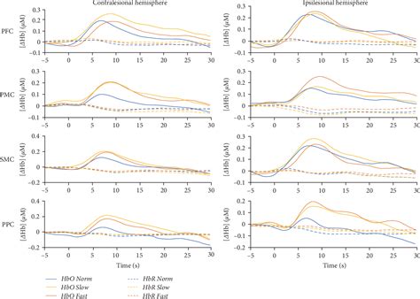 Figure 1 From Premotor And Posterior Parietal Cortex Activity Is