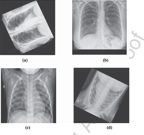 Figure 1 From Hyperparameters Optimization For Resnet And Xception In The Purpose Of Diagnosing