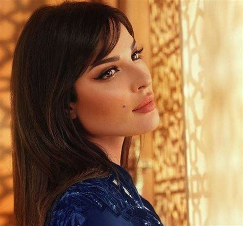 بالصور هكذا باتت الندوب في وجه نادين نسيب نجيم من دون مكياج وتعديل