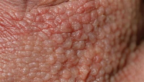 Premium Photo A Close Up Of A Persons Skin With Red Bumps