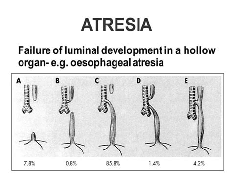 Malformations Ppt