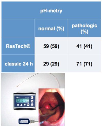 Laryngopharyngeal PH Monitoring Restech Correlation With