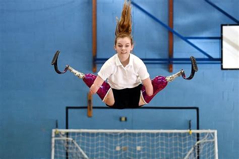 Youtube Sensation Isabelle Weall A Quadruple Amputee Shows That