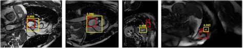 Examples Of Failure Detection Results By Our Method Where Red Download Scientific Diagram