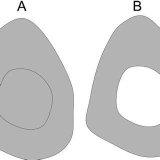 Schematic Illustration Of The Cross Sectional Plane Of The Tibial Download Scientific Diagram
