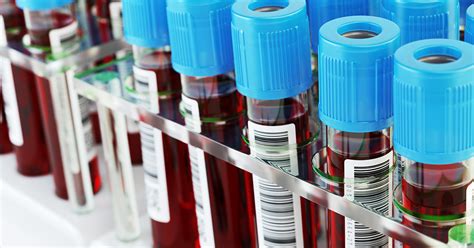 Mandatory Blood Tests For Those Who Spit At Or Bite Police Or Emergency