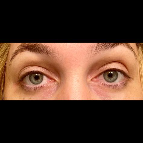 My Turn Whats My Eye Shape 🙏 Please Help R Makeupaddiction