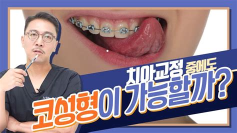 84화 코성형수술 하고 싶은데 치아교정기를 떼고 해야 하나요 Youtube