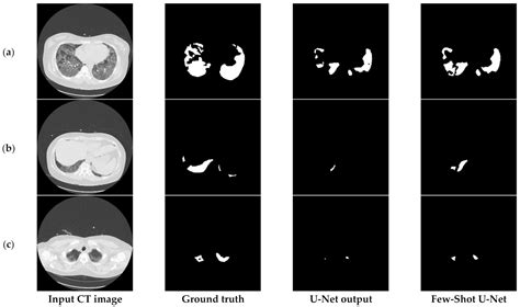 Sensors Free Full Text A Few Shot U Net Deep Learning Model For