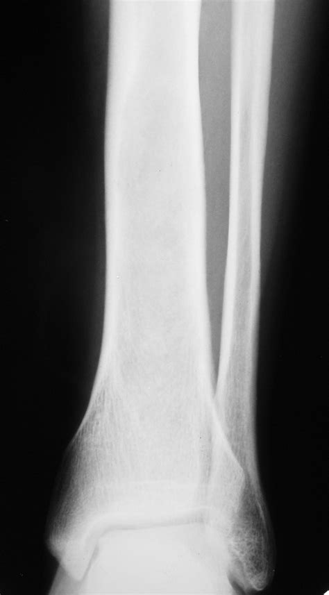 Ucsd Musculoskeletal Radiology