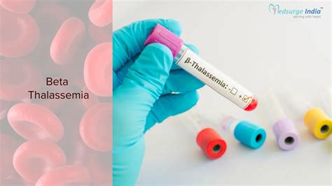 Beta Thalassemia Mutation Symptoms And More😀 Desafie Seus Limites