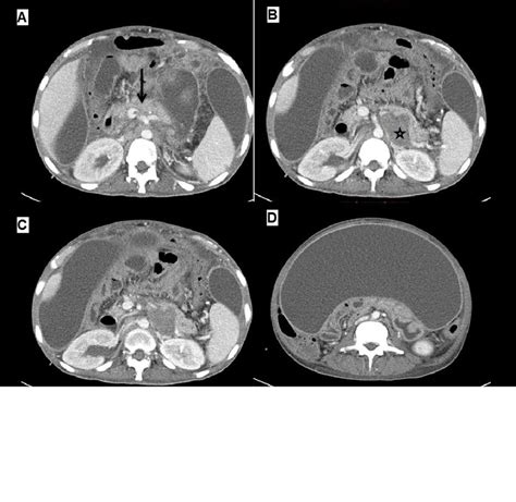 Series Of Contrast Enhanced Ct Images Axial Section Soft Tissue
