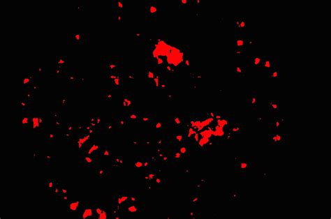 Improving Lesion Segmentation For Diabetic Retinopathy Using