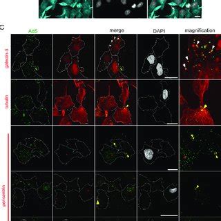 Nuclear Factors Are Required To Remove Ad From The MTOC A Protocol Download Scientific