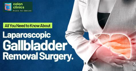 Best Laparoscopic Gallbladder Removal Surgery In Visakhapatnam Dr