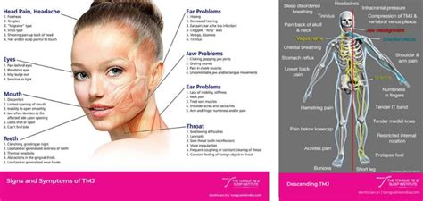 Connection Between Tmj And Body Posture Tmj Tongue Tie And Sleep
