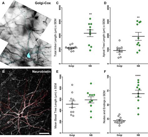 Basolateral Amygdala Bla Principal Neuron Dendritic Arbors From Download Scientific Diagram
