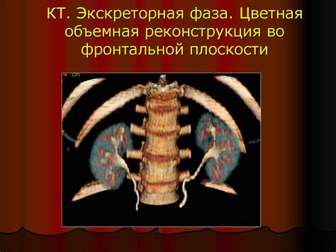 Селективная почечная ангиография Артериальная фаза презентация онлайн