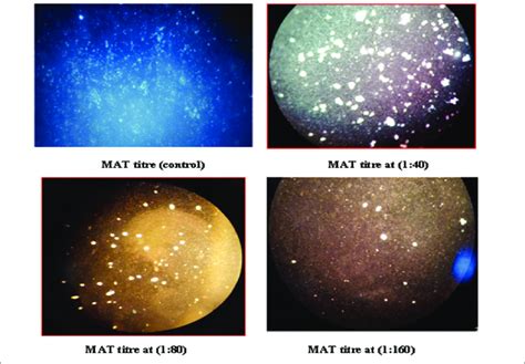 Showing Agglutination At Different Mat Titre Of The Positive Samples