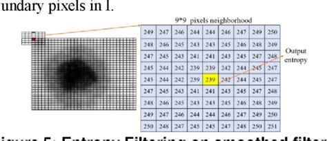 Figure 5 From Melanoma Classification On Dermoscopy Skin Images Using Bag Tree Ensemble