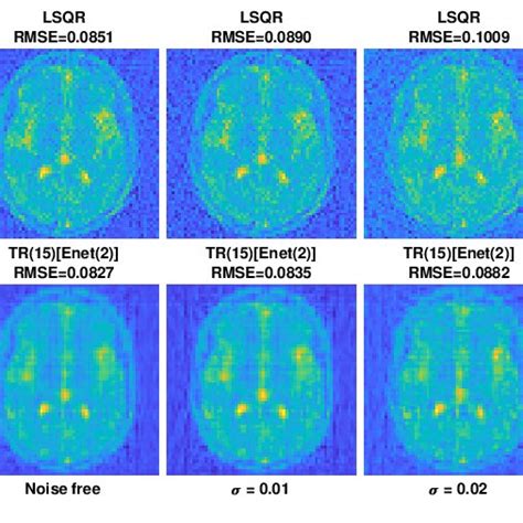 Reconstruction Comparison Of Tr And Lsqr For The Mri Brain Image Top
