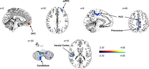Motor Learning Related Spatial Covariance Pattern In Subjects With Download Scientific Diagram