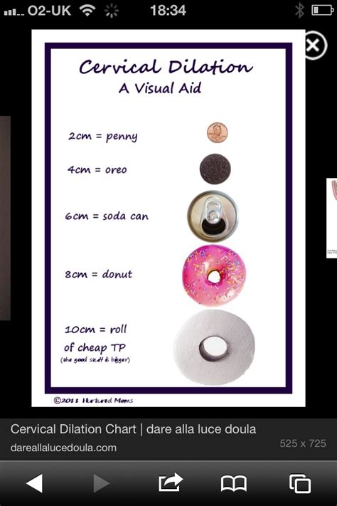 Teaching Matt The Essentials Cervical Dilation Chart Teaching Dilations