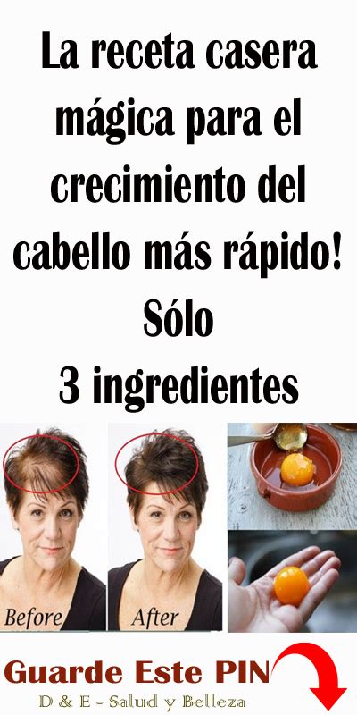 Receta mágica para un rápido crecimiento del cabello Crecimiento del