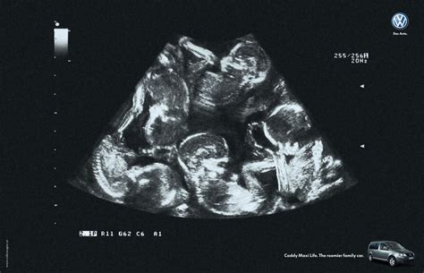 Sextuplets Ultrasound