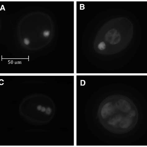 Microspore With Small Nucleus Stained With Dapi Arrows Indicate Two