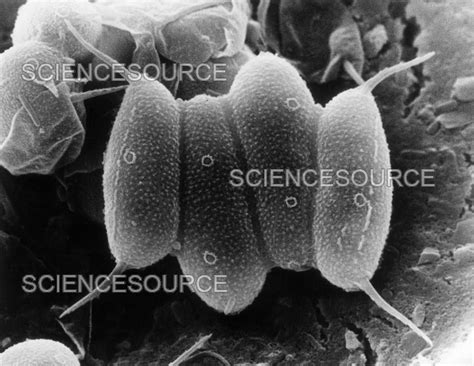 Scendesmus Algae Sem Stock Image Science Source Images