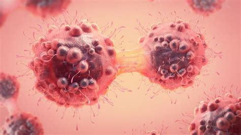 Identifying Undiagnosable Cancers Using Machine Learning Technology
