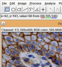 Advanced Functions Slide Set Batch Processing For ImageJ