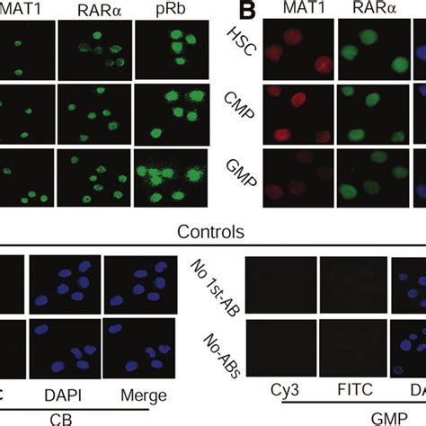 Rar Cak Signaling Proteins Are Expressed In Primary Hsc Cmp And Gmp