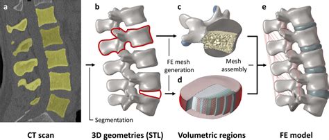 Construction Of The Finite Element Model Of The Intact Lumbar Spine Download Scientific