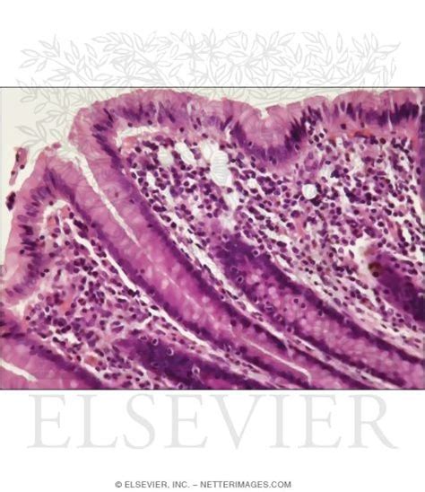 Light Micrograph Of The Mucosa Of The Appendix Showing Galt