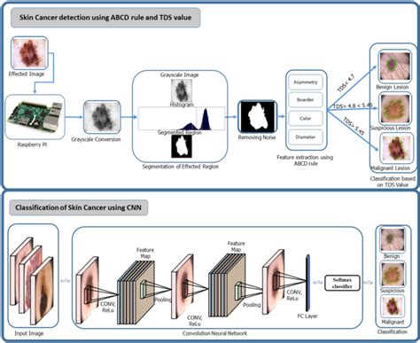 handcrafted and cnn feature extraction framework for skin cancer download scientific diagram