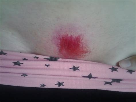 Dyed Pubic Hair Kolorowe Fryzurki Porn Pictures Xxx Photos Sex