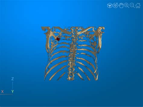 Display Labeled Medical Image Volume In Patient Coordinate System Matlab And Simulink