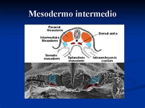 Embriologa Desarrollo Sistema Urinario Mesodermo Intermedio Sistema Urogenital
