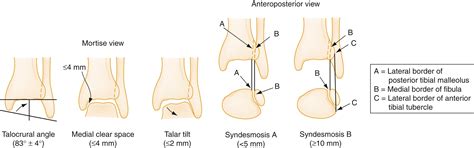 Ankle And Foot Injuries Clinical Tree